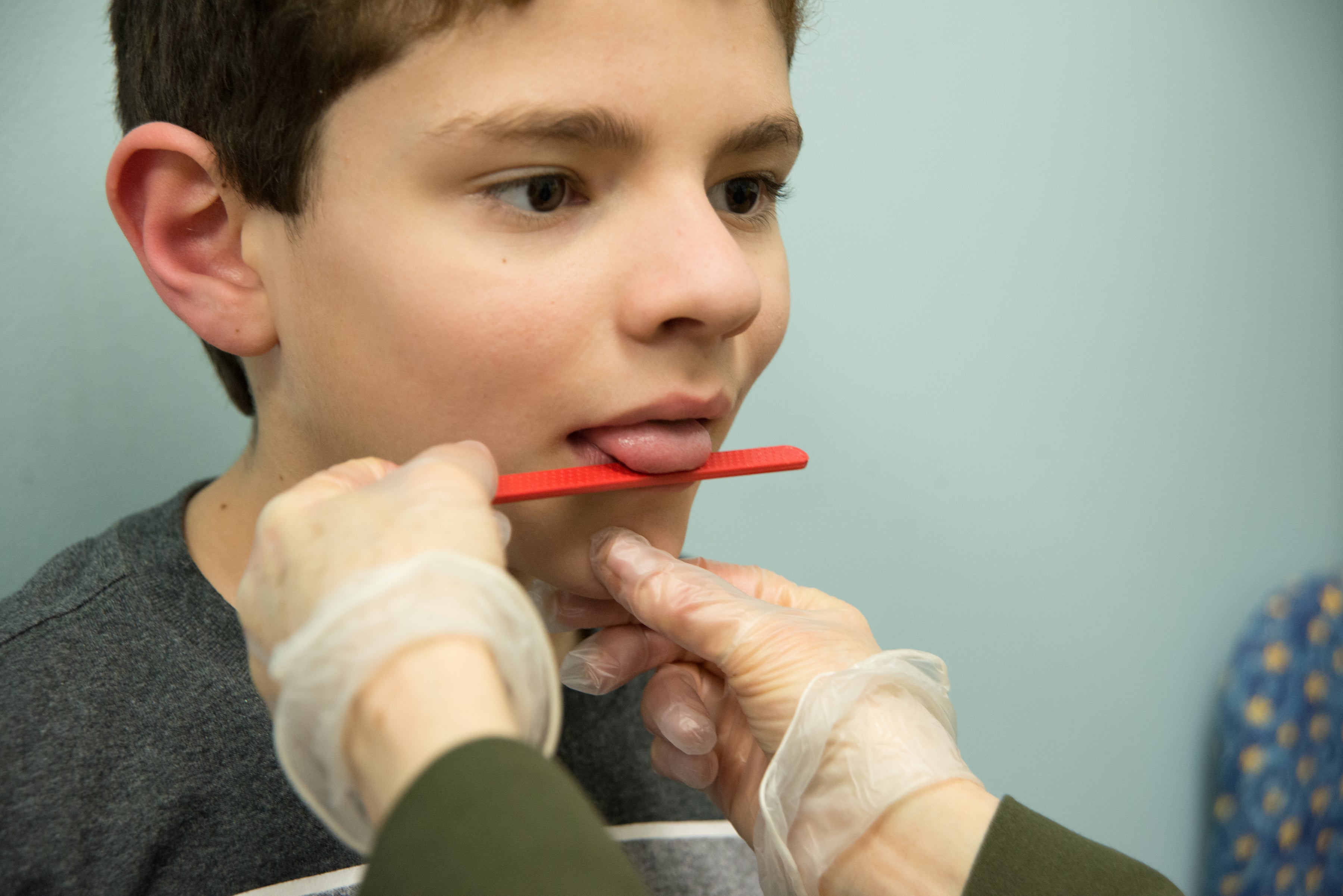 Oral Placement Therapy: Clinical Implications for Tongue Thrust and Li ...